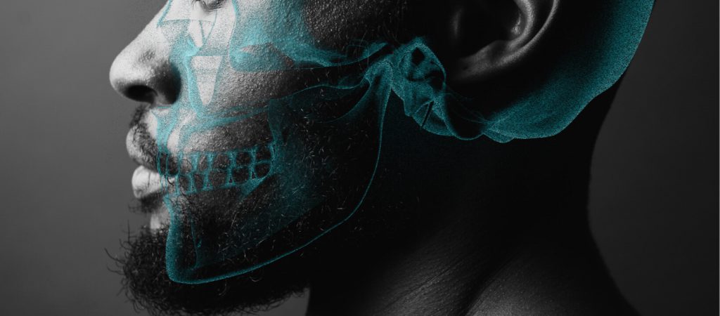 Skullpture — Facial Bone Surgery