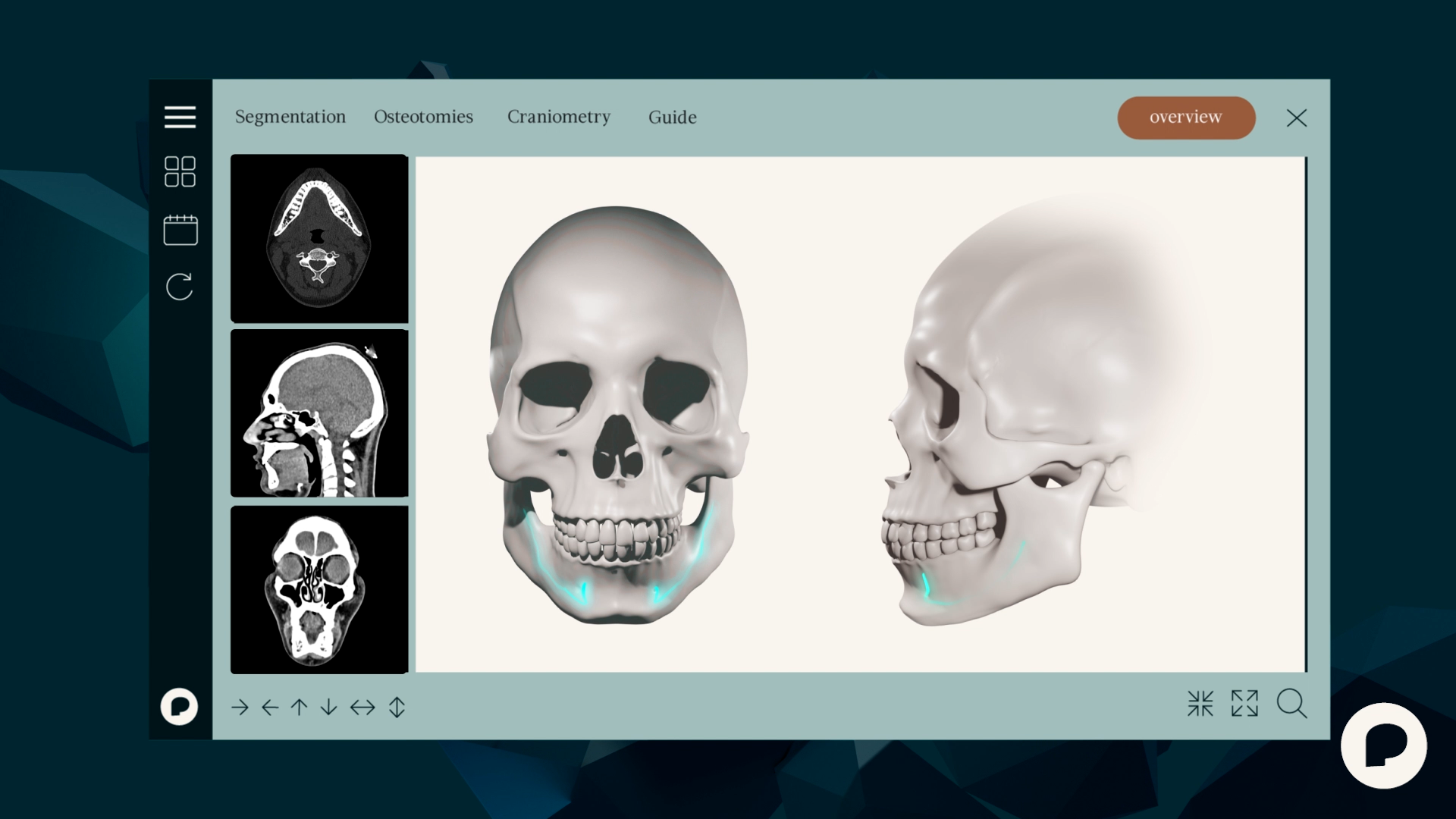 Minimally Invasive Chin Surgery Explained — Skullpture